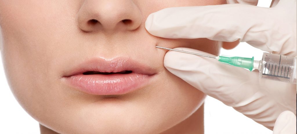 Nasolabial Filling - Turkiye (Turkey) - Istanbul